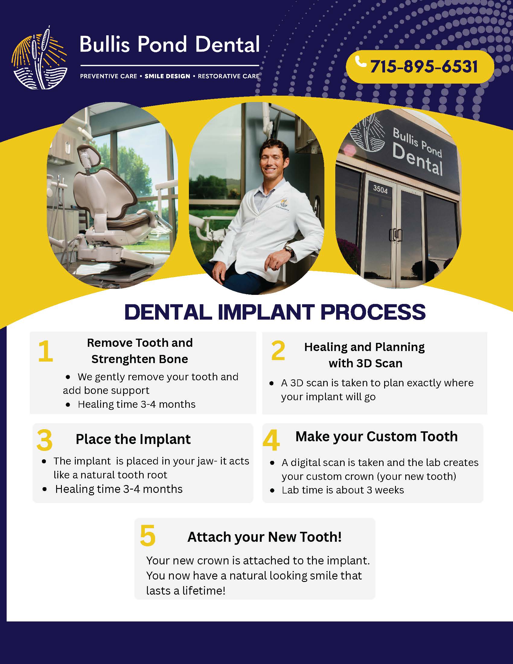 Dental Implants - Bullis Pond Dental | Eau Claire, WI